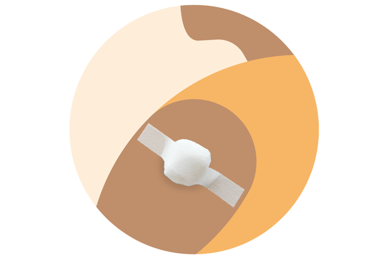 Norwegian Institute of Public Health - NIPH